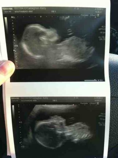 20 week scan relief!!