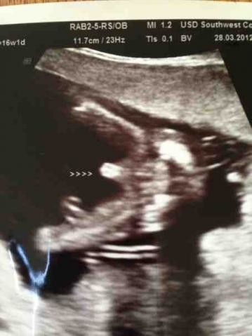private gender scan at 16 weeks
