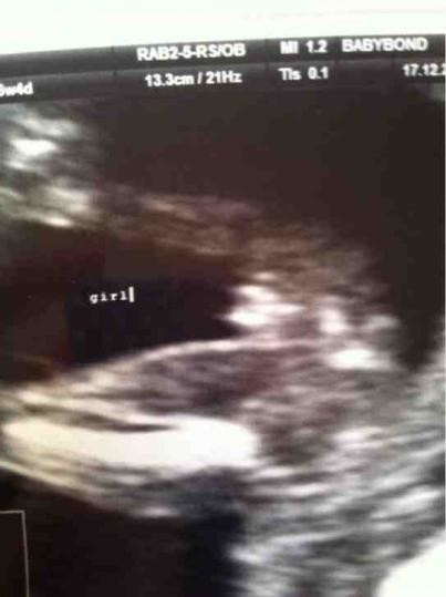 private gender scan at 16 weeks