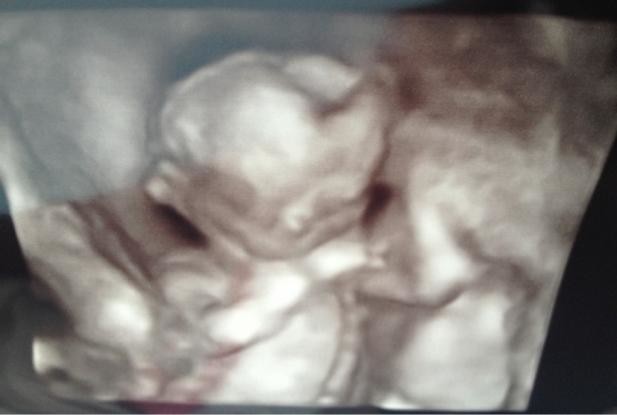Confirmed Boy at 16 week scan!