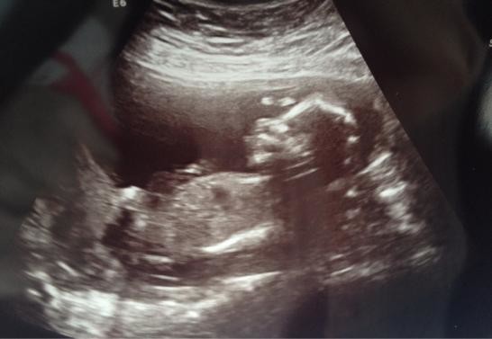 Confirmed Boy at 16 week scan!