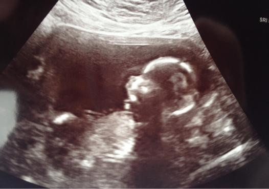 Confirmed Boy at 16 week scan!