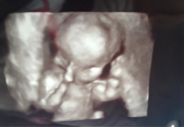 Confirmed Boy at 16 week scan!