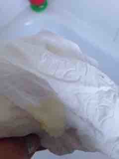 TMI TMI TMI HELP!!! Is this my mucus plug?? I'm only 17 weeks! TMI PHOTO!