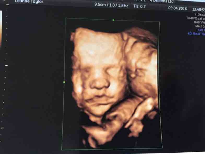 4d Scan at 25 weeks - Page: 2