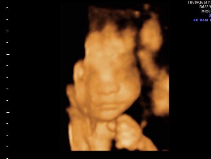 4d Scan at 25 weeks - Page: 2