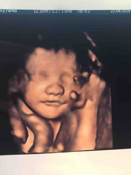 Show me your 3d/4d scan photos!! :)