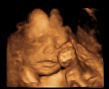 Did anyone have a 4d scan at 26 weeks?