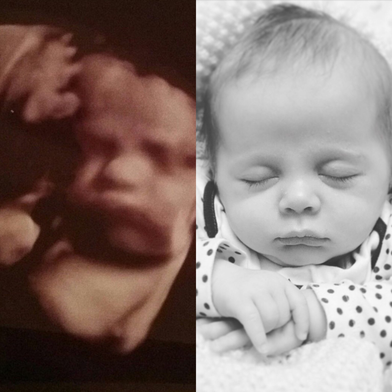 Had this scan at 38 weeks and first thing I noticed was his nose and ...