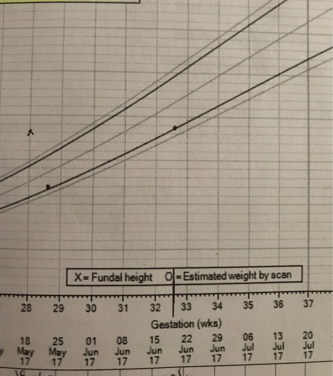 Size of baby at 34 weeks growth scan?