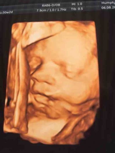 3D/4D scan at 30 weeks??