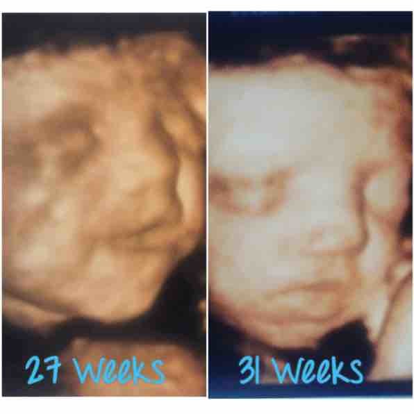 3D/4D scan at 30 weeks??