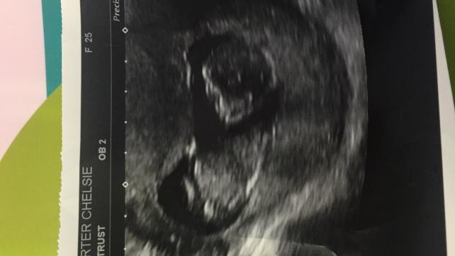 Post your clear forward facing 12weeks scans!!