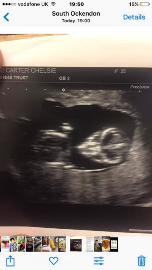 Post your clear forward facing 12weeks scans!!