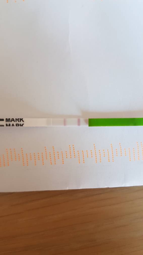 Cd25 positive opk???