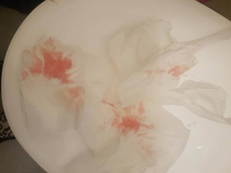 TMI Help please possible implantation !!! 5 DPO & BLEEDING!!