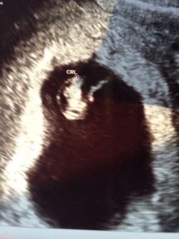 7 weeks pregnant and aching left side....tell me this is okay???