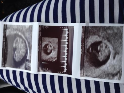 Early private scan 9 weeks, internal or external?!