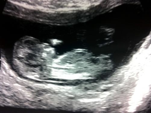 12 week scan...