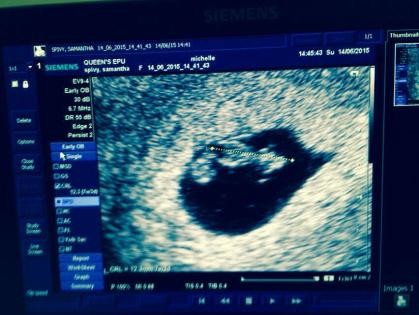 what can you see at 7 week scan