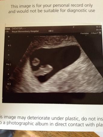 what can you see at 7 week scan