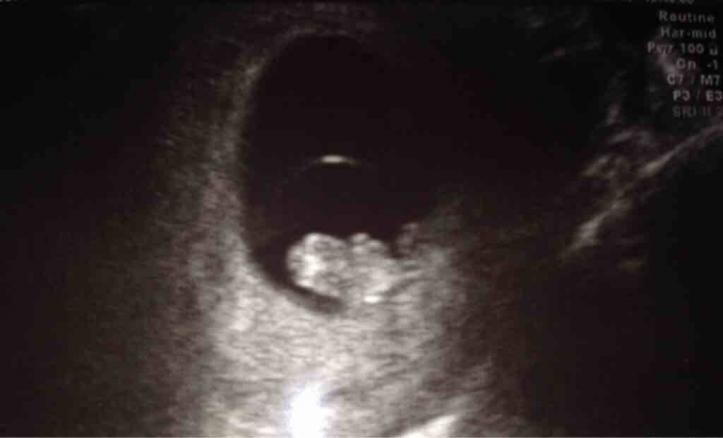 8 week scans - Page: 2