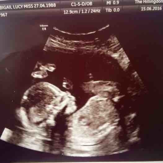 16weeks gender scan