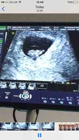 early scans and internal scan?? whats it like?