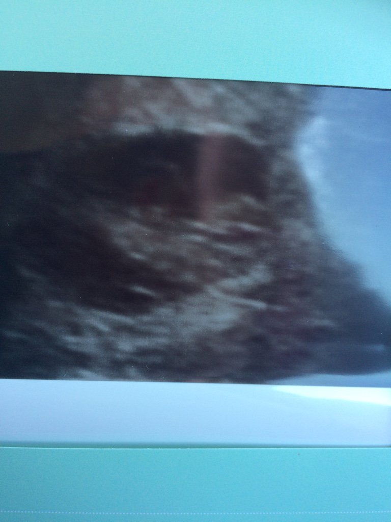 8 Weeks Scans - Can i see your pictures please