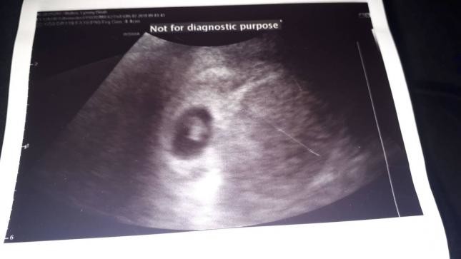 Early scan at 6 weeks, show me your pics!