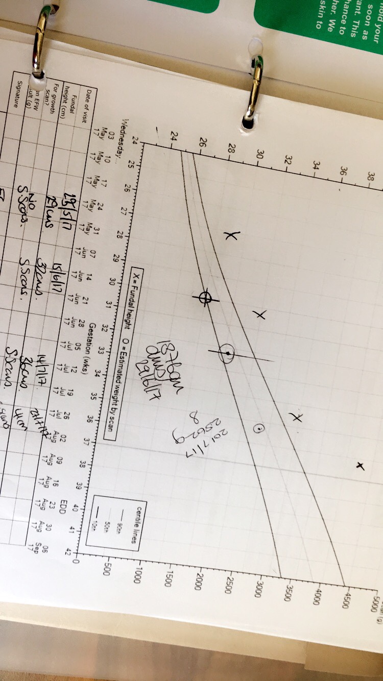 Baby movements and patterns