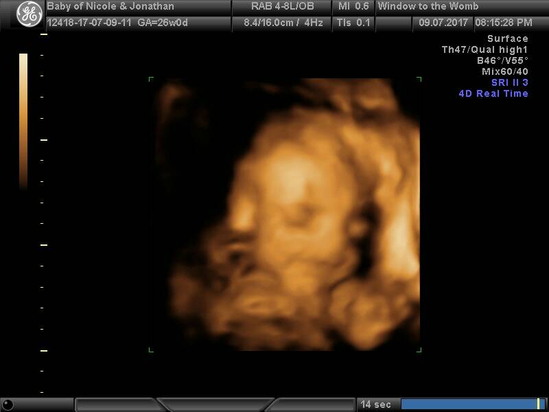 My amazing 4D scan at 33 weeks