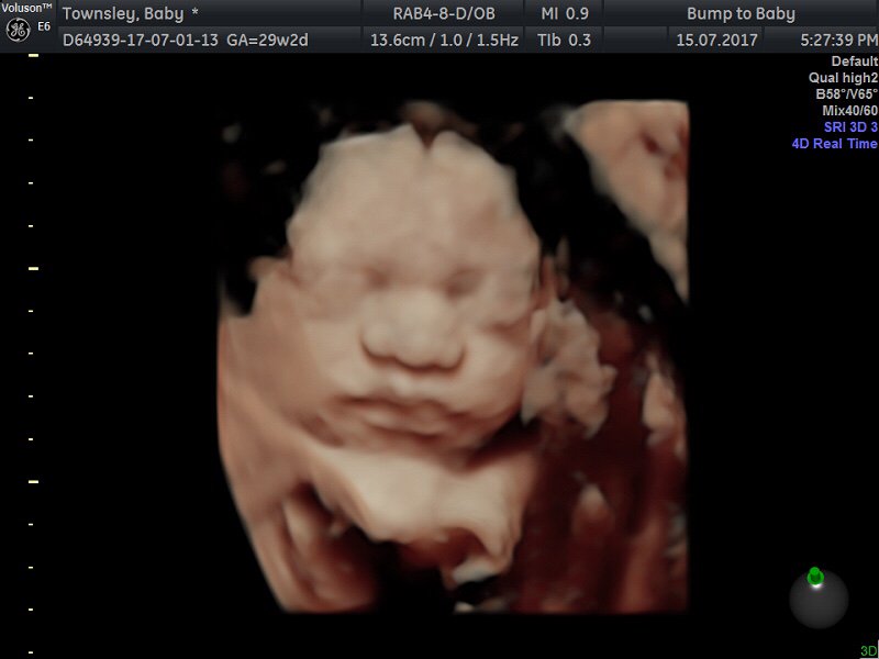 My amazing 4D scan at 33 weeks