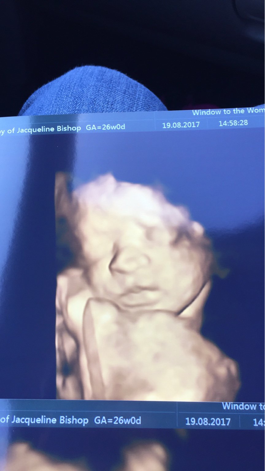My amazing 4D scan at 33 weeks