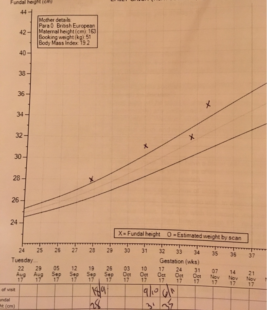 Would you expect a growth scan with this graph?