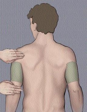 Anyone else injecting clexane?