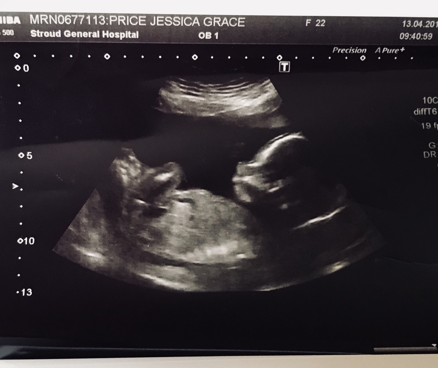 Nub guesses please 13 weeks