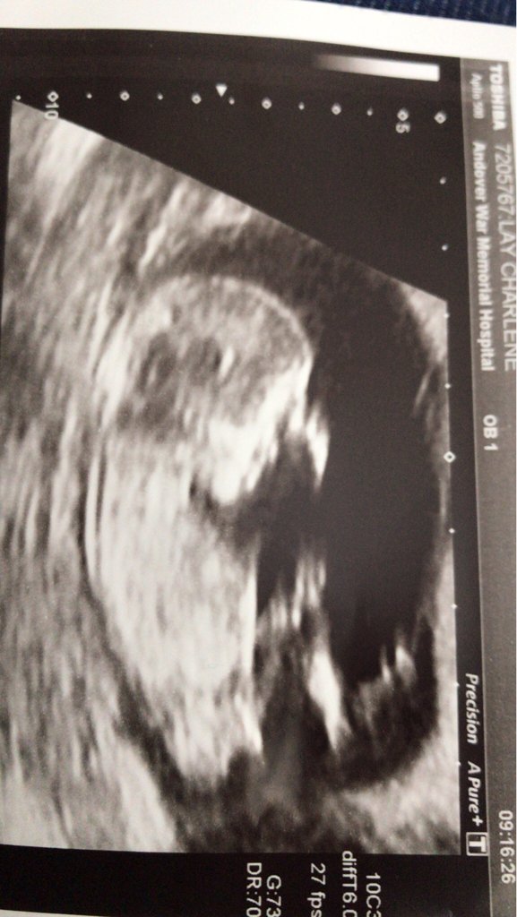 Guess the gender from scan pics