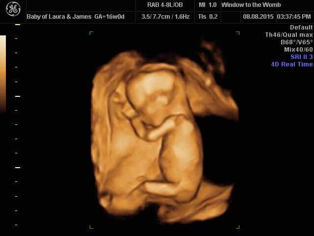 16weeks 4D Gender scan??
