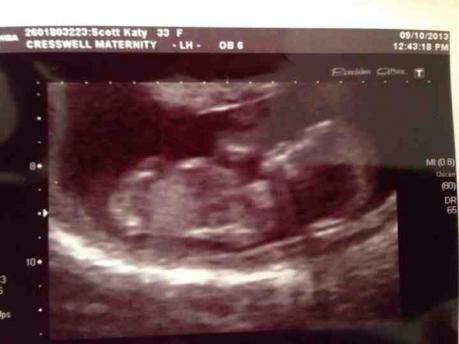 What does a 8 week scan look like..