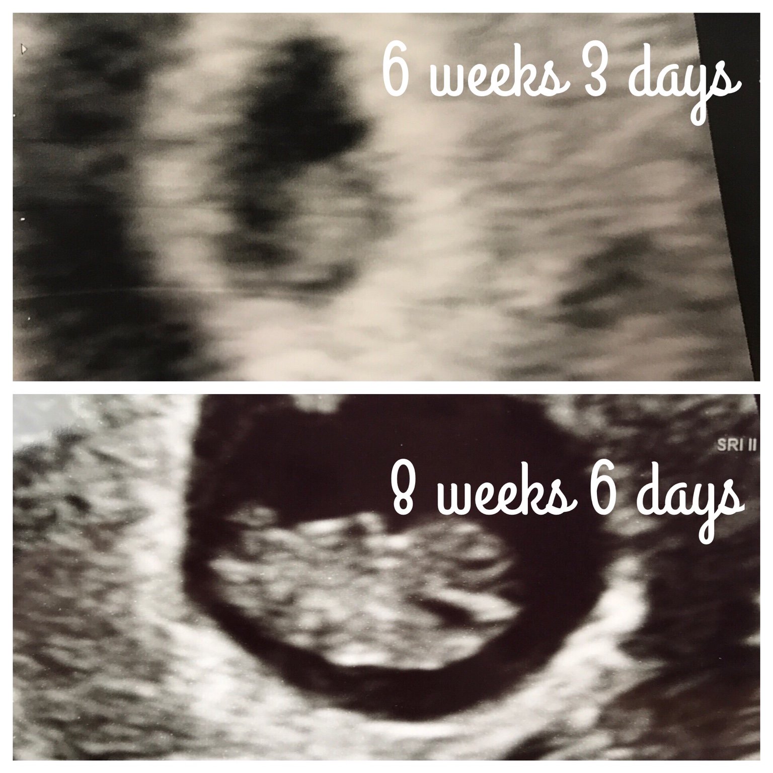 6 week scan