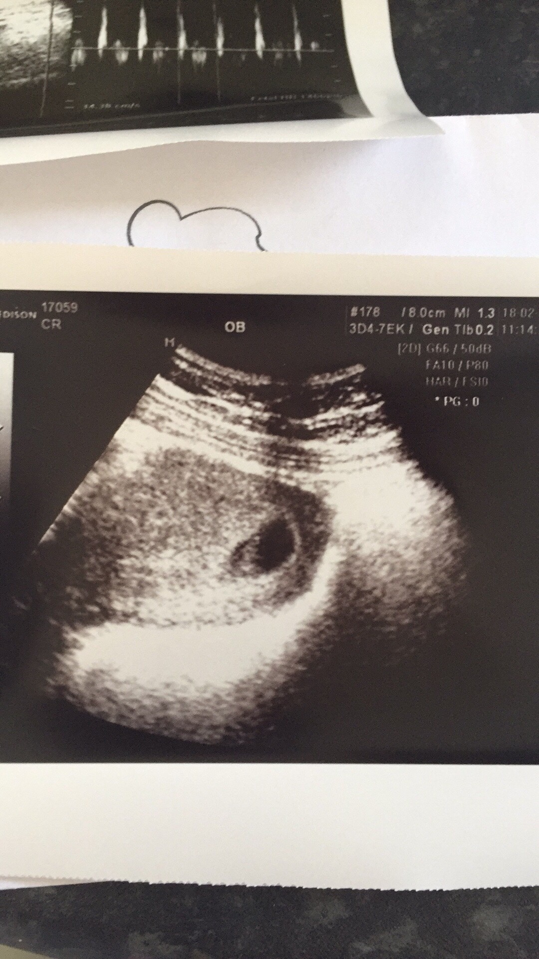 Ultrasound scans at 8 weeks pics. - Page: 3