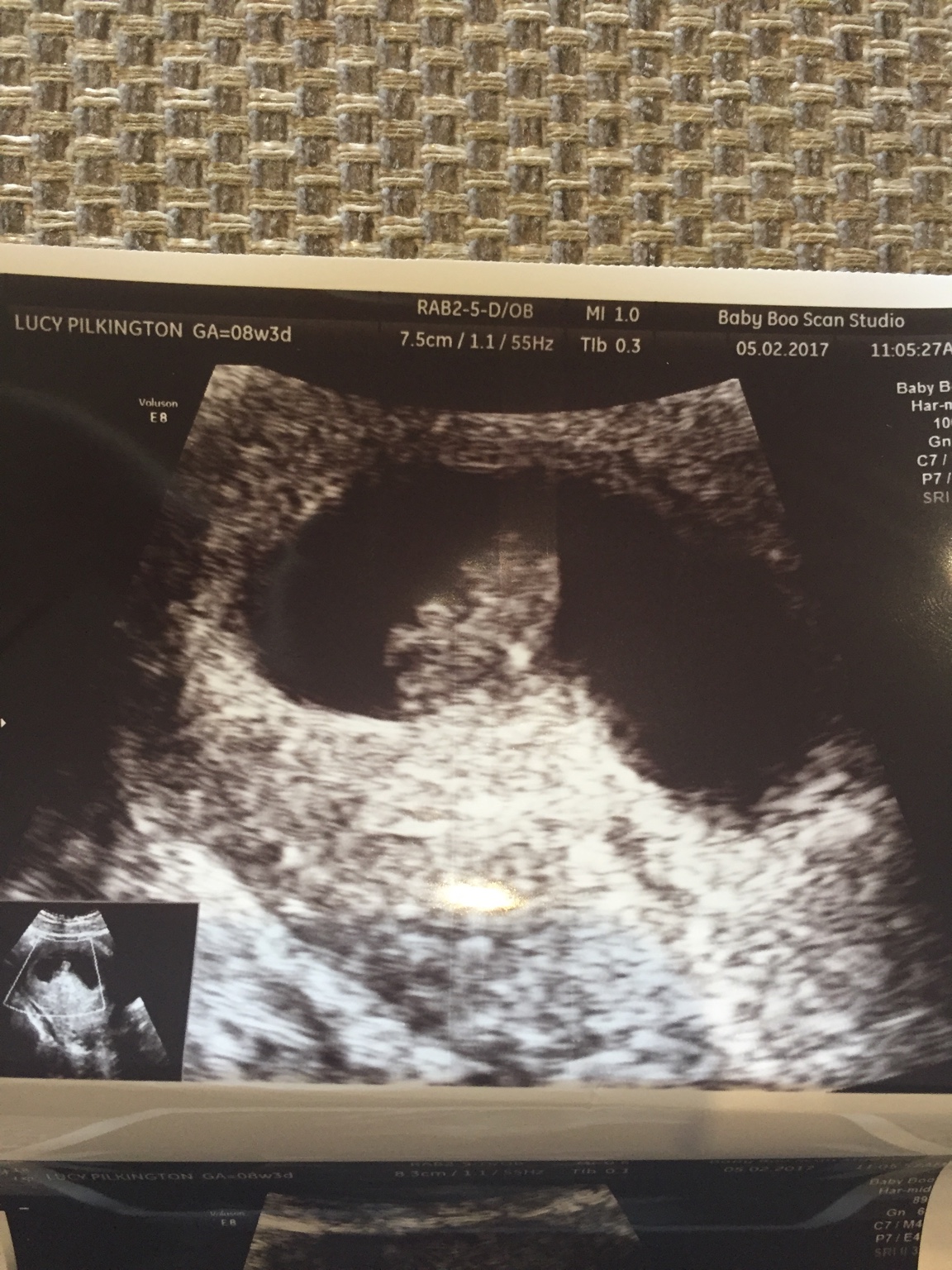 Ultrasound scans at 8 weeks pics. - Page: 2