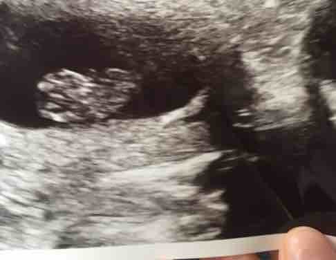 Booked early scan for 9 weeks. Will I see anything or stress myself out ...