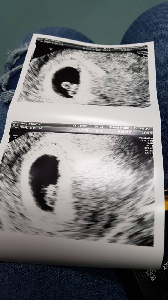 scan pics at 6 weeks