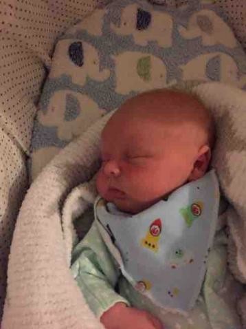 Anyone else's baby born bruised?