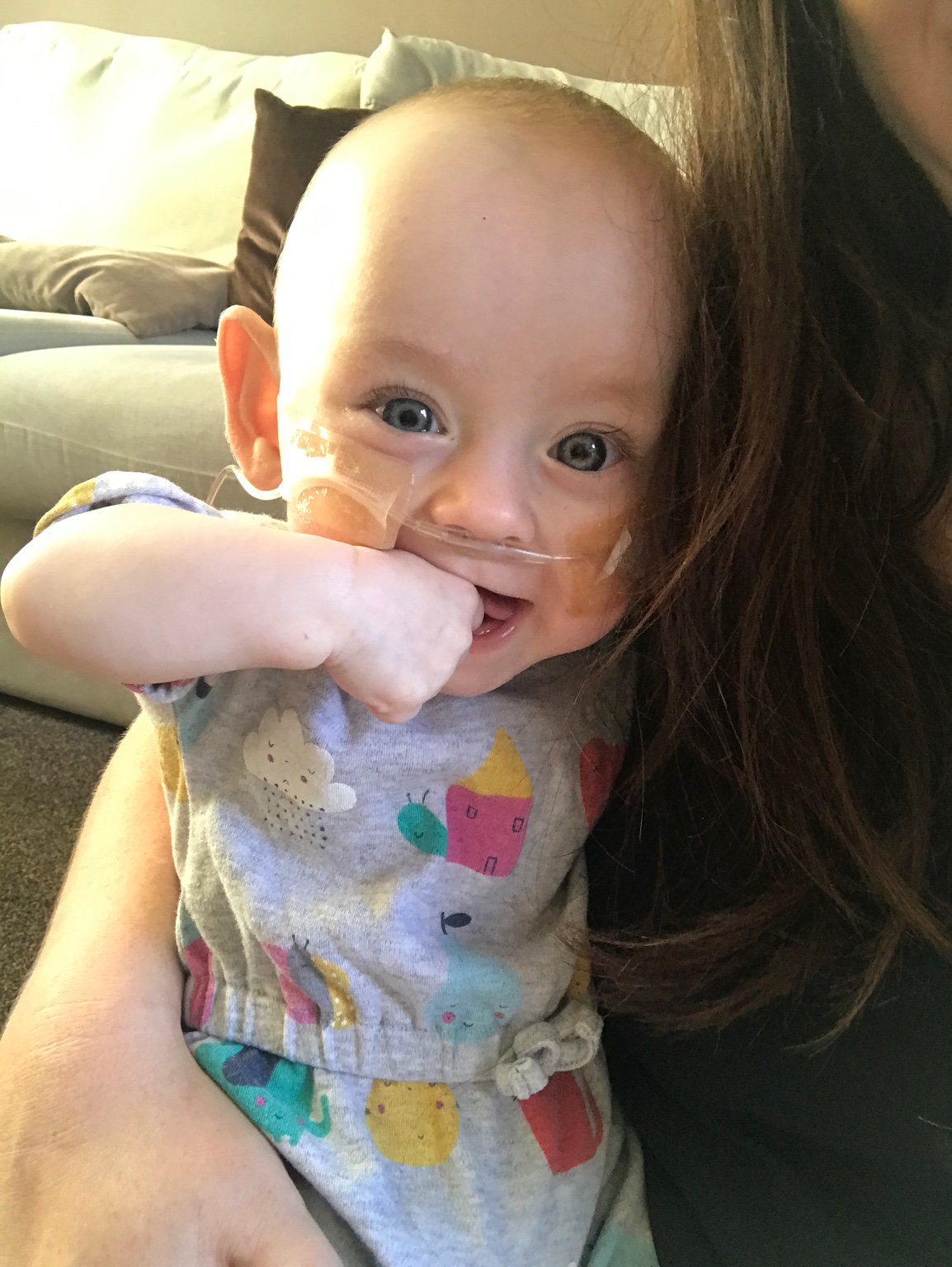 Twin boys born at 24 weeks