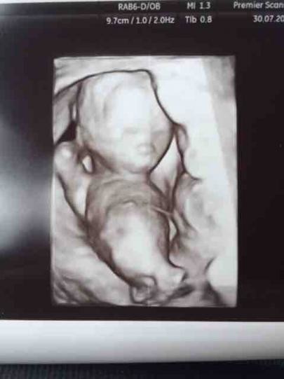 Anatomy scan..baby looks funny!