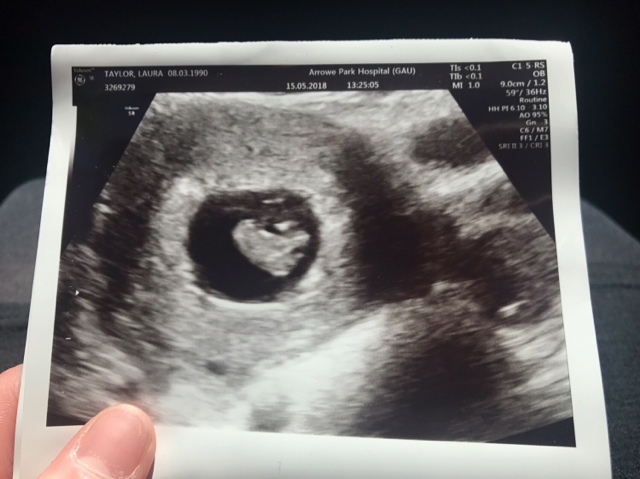 Scan pics - 8w 1d