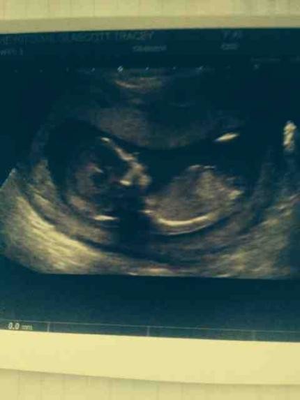 Confirmed genders from 12 week scans for people to compare - Page: 2